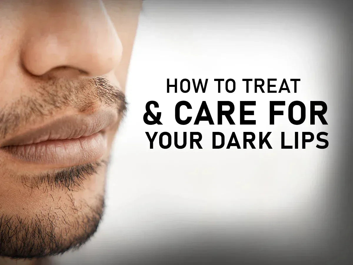 Lip Pigmentation: How to Treat and Care for Your Dark Lips – White Wolf ...