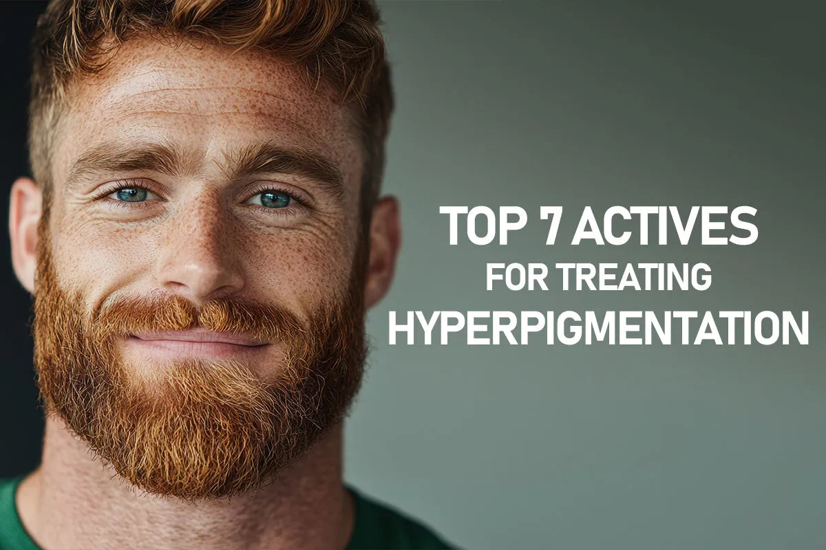 Top 7 Actives for Treating Hyperpigmentation – White Wolf India